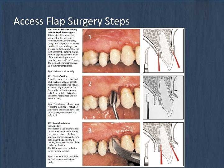 GROUP AND INDIVIDUAL LEARNING BDS 4 Periodontics 2017