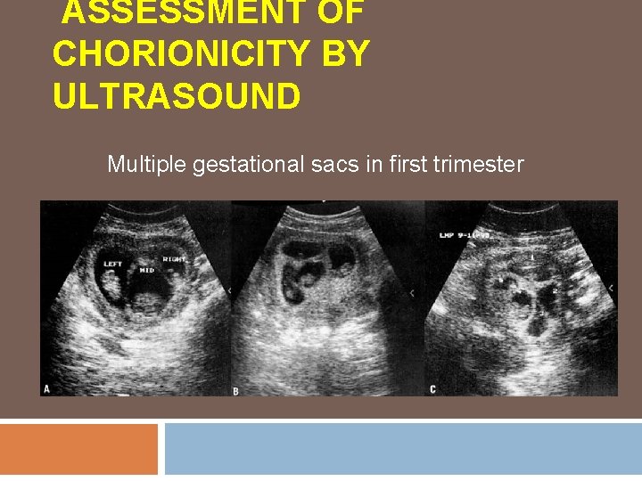 King Khalid University Hospital Department of Obstetrics Gynecology