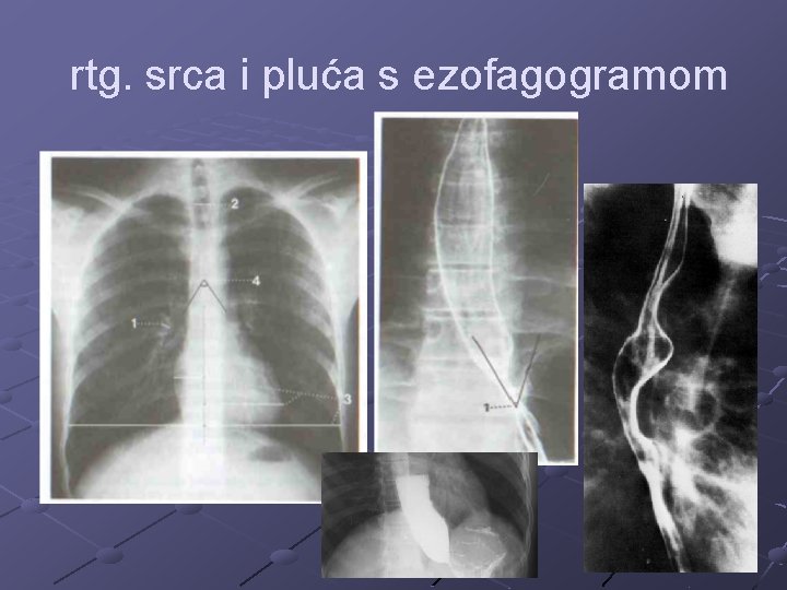 KONVENCIONALNE RADIOLOKE METODE RTG PREGLEDI TORAKALNIH ORGANA Prof