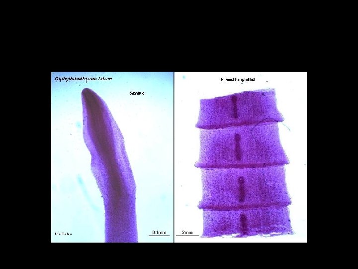 Diphyllobothrium latum Dr Bindhusaran Assistant Professor Department of