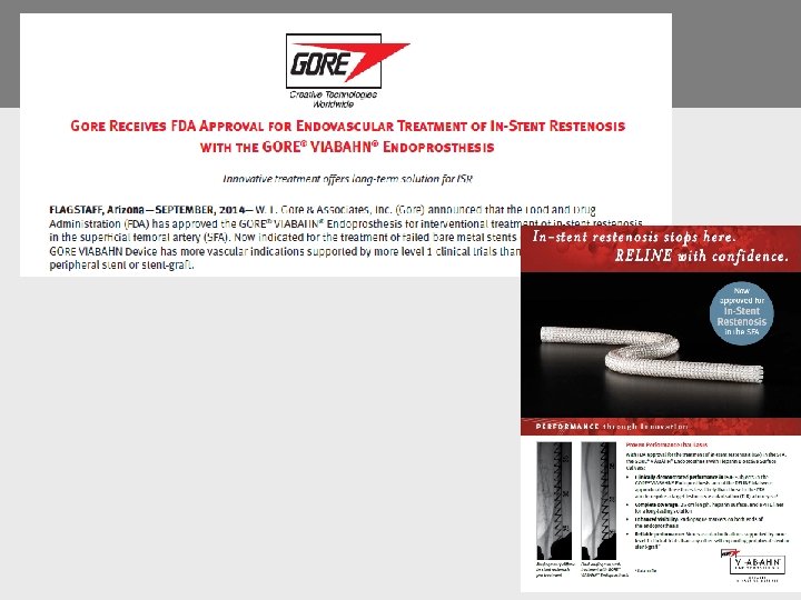 GORE VIABAHN Endoprosthesis GORE VIABAHN and designs are