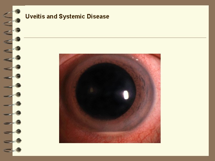 Uveitis and Systemic Disease Classification When to investigate