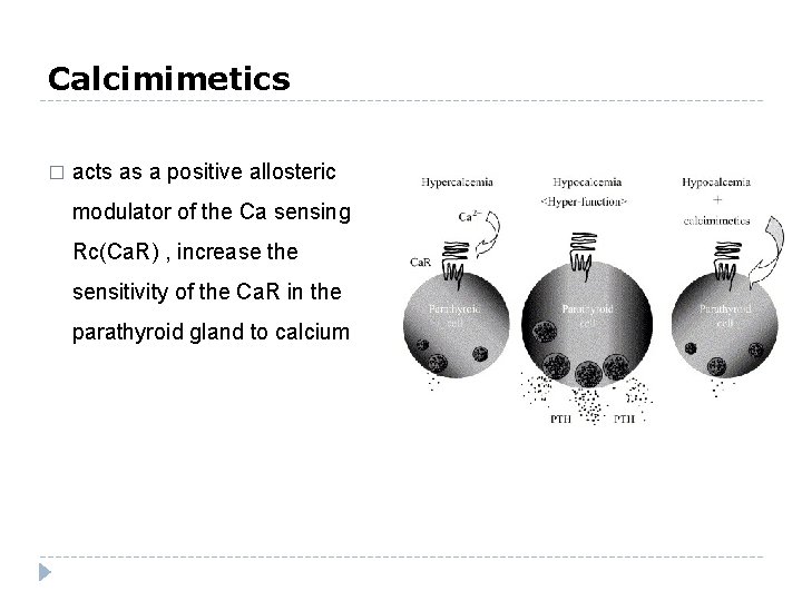 Management of Bone Mineral Disorder in Dialysis Patients