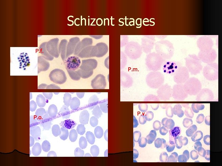 PARASITIC DISEASES CAUSING ANAEMIA Prof Dr Supargiyono DTMH