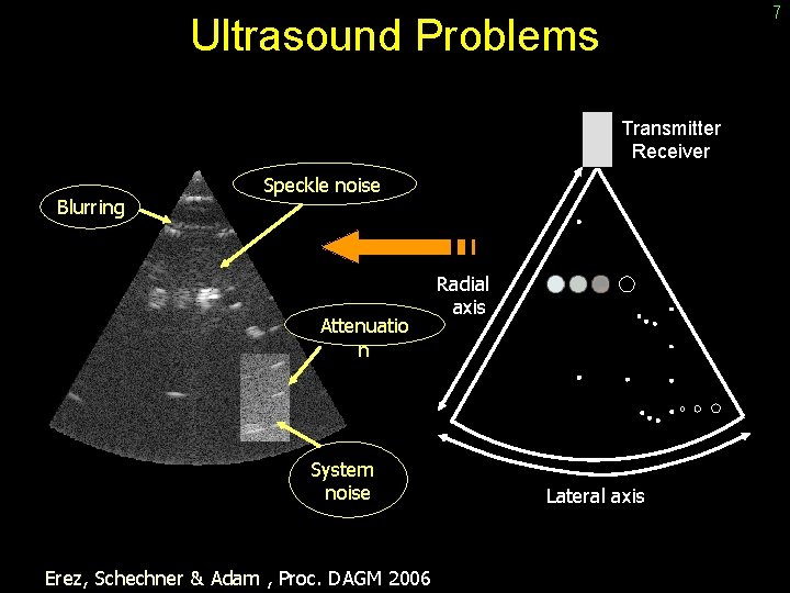 1 Ultrasound Image Denoising by Spatially Varying Frequency