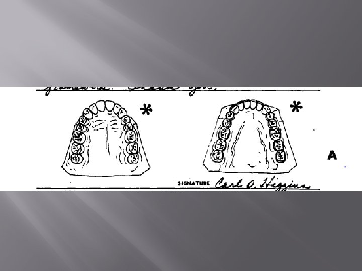 Work AUTHORIZATION FOR REMOVABLE PARTIAL DENTURES A work