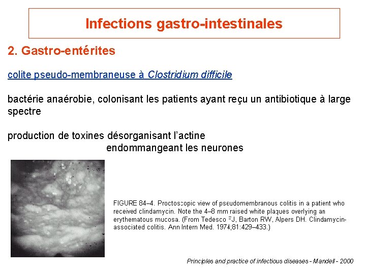 Infections gastrointestinales 1 Gastrite Helicobacter pylori ...