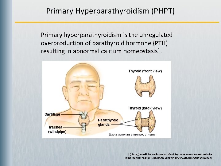 Primary Hyperparathyroidism in the Geriatric Population Nahid Rianon