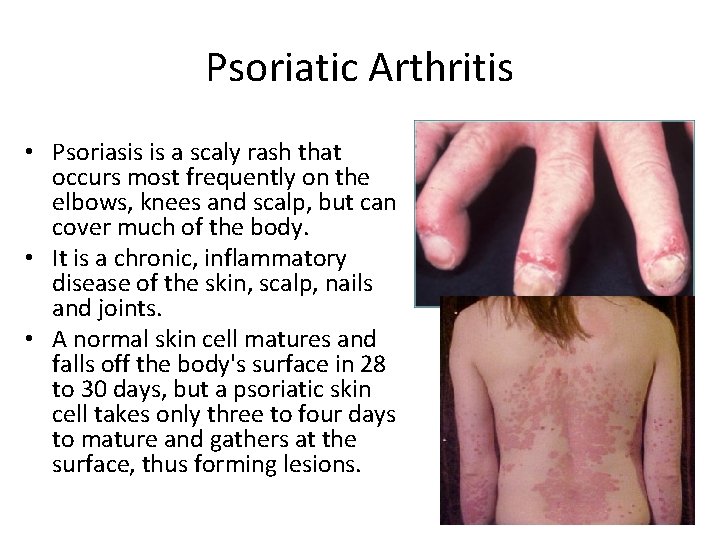 Uveitis Systemic and Ocular Approaches to Management Blair