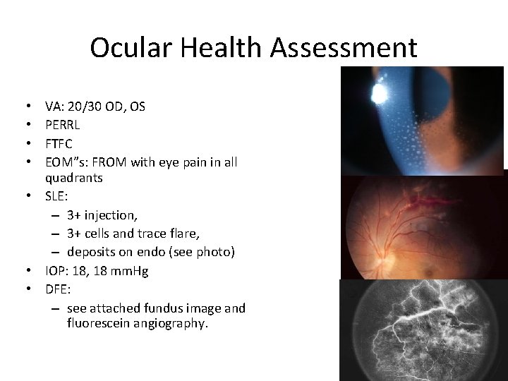 Uveitis Systemic and Ocular Approaches to Management Blair