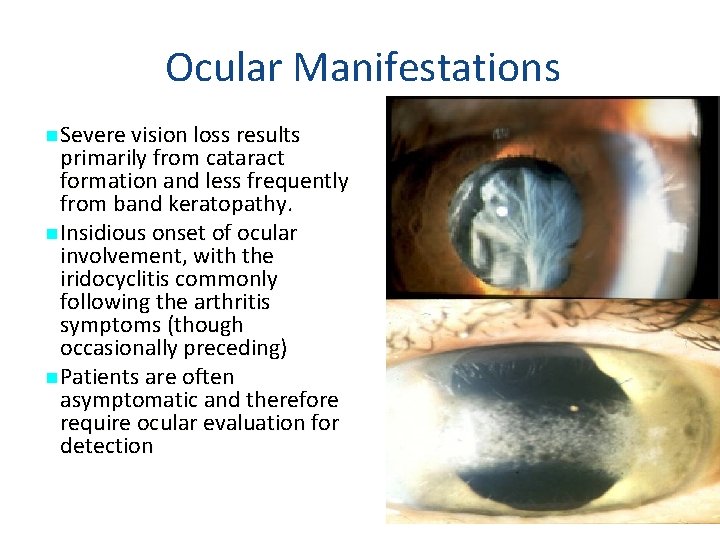Uveitis Systemic and Ocular Approaches to Management Blair