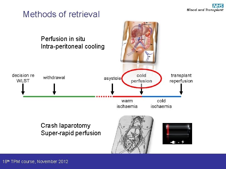 Maastricht Classification of DCD Definition I Where Dead