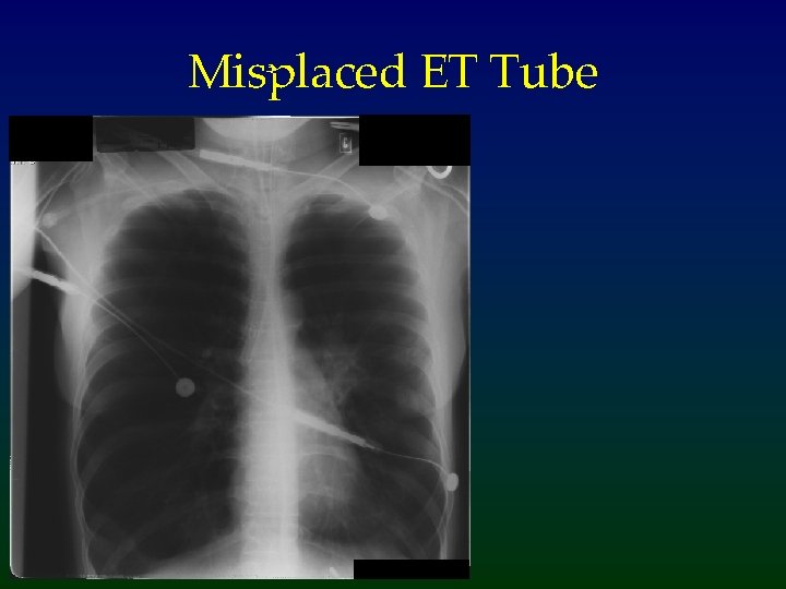 Lines and Tubes What are the common lines