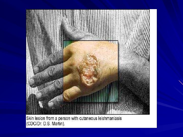 BLOOD TISSUE FLAGELLATES HAEMOFLAGELLATES Morphologic forms There are