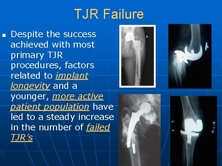 Modes of Failure in Revision Hip and Knee