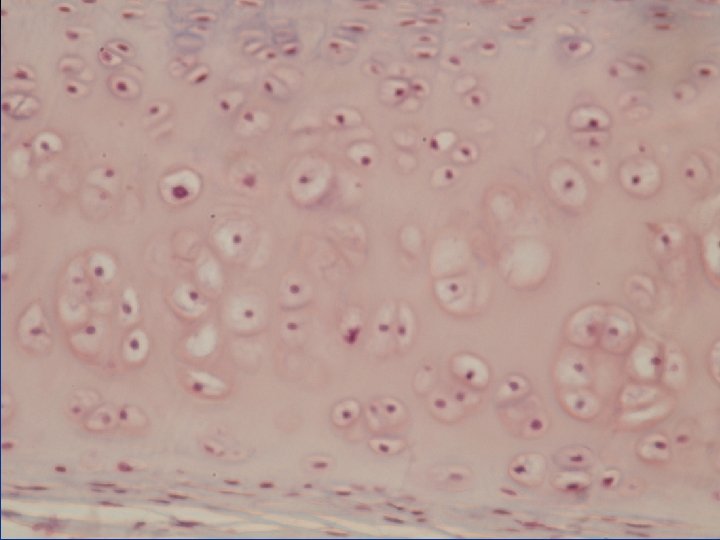 ESUTURILE CARTILAGINOASE Clasificarea esuturilor conjunctive esuturi ...