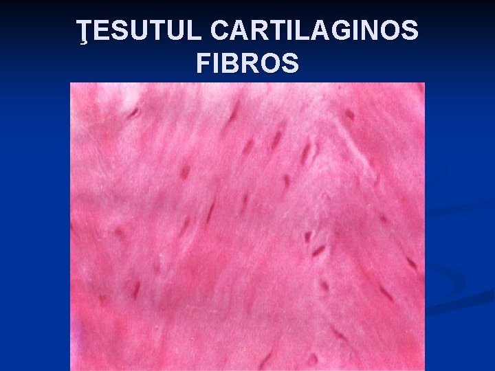 ESUTURILE CARTILAGINOASE Clasificarea esuturilor conjunctive esuturi ...