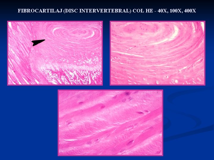 ESUTURILE CARTILAGINOASE Clasificarea esuturilor conjunctive esuturi ...