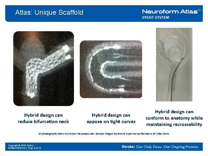 INTRODUCTION TO NEUROFORM ATLAS Caution Investigational device Limited