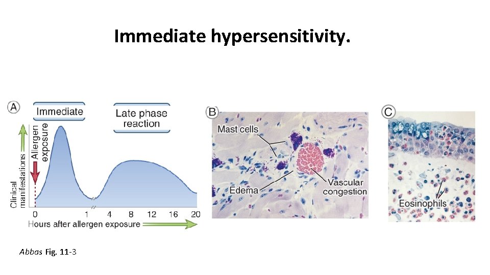 Hypersensitivity Class 11 Slides September 27 th 2016