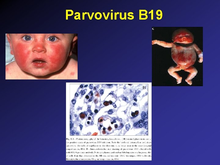 CONGENITAL INFECTIONS Dr Mohammad A Khan MD Ph