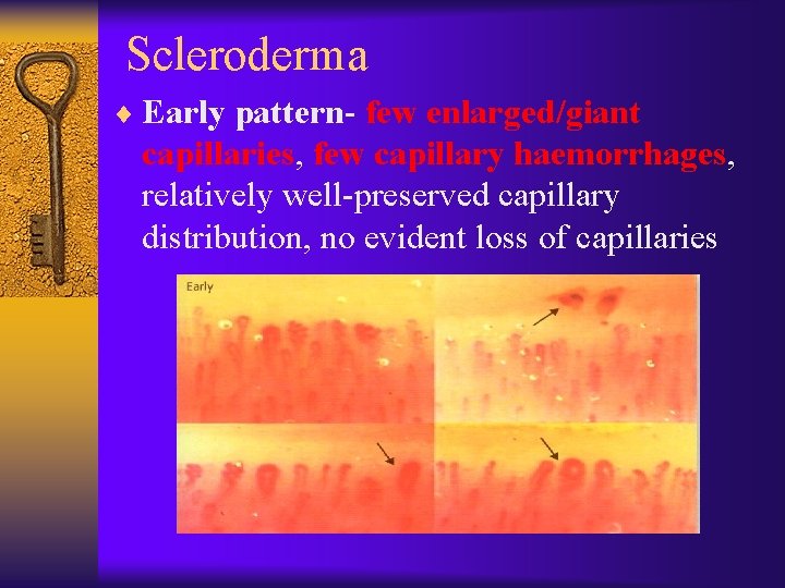 Nailfold capillaroscopy Joanna Zalewska Definition best method to