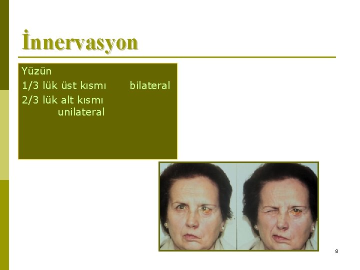 Fasial Paralizi 1 10 000 lif 7000 3000