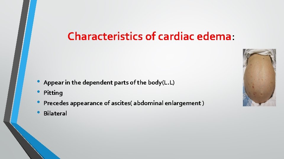 Pathogenesis of cardiac symptoms Dr Rehab F Gwada