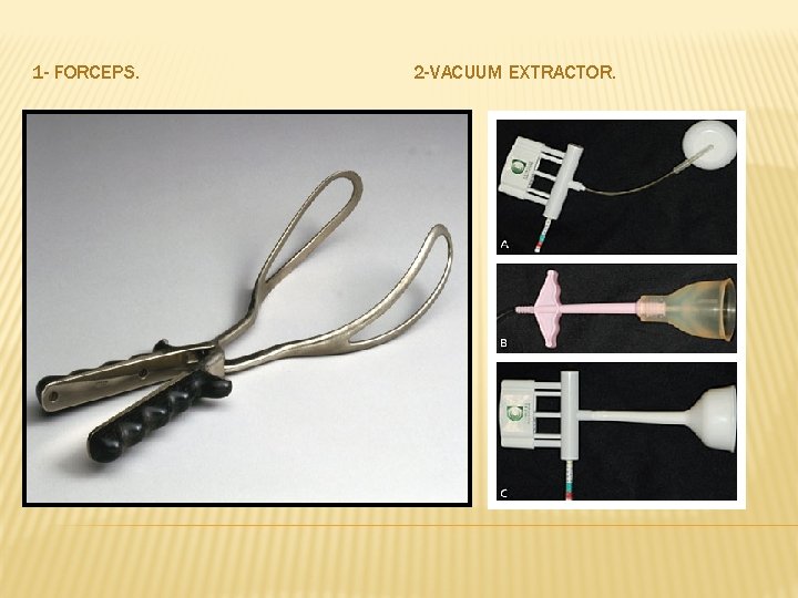 OPERATIVE VAGINAL DELIVERY Dr Jina khalid mohammed fadl