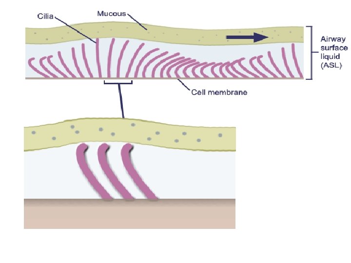 Diseases of the Respiratory System Bronchitis Bronchioles inflamed