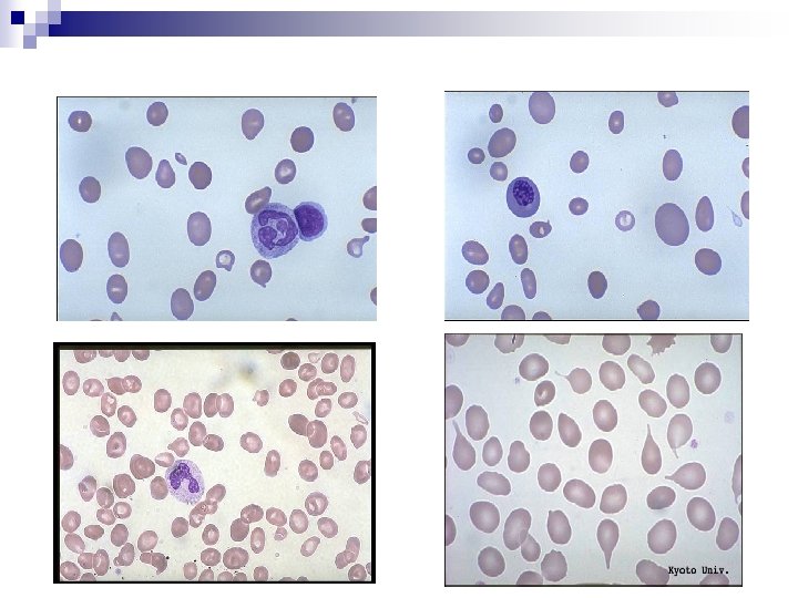 Metabolismo de la Vitamina B 12 y del