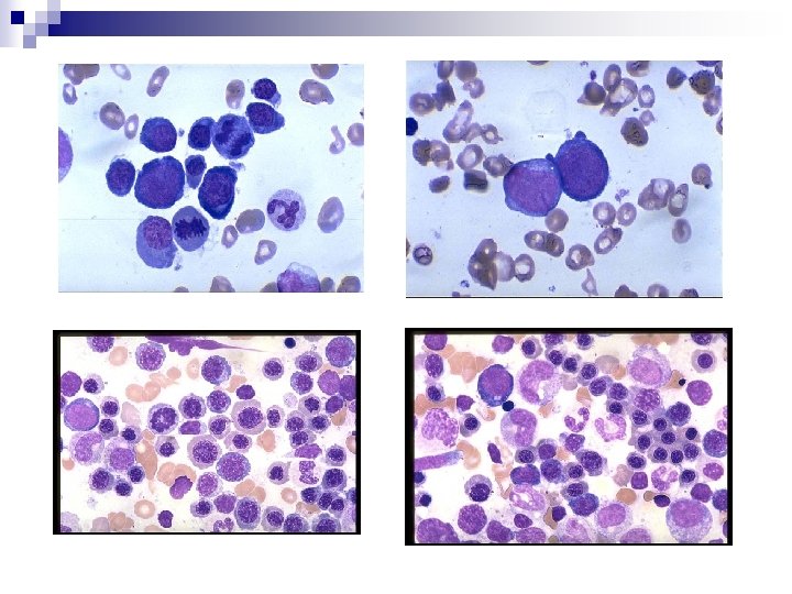 Metabolismo de la Vitamina B 12 y del