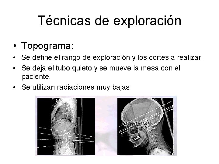 Tomografa Computada NIB Facultades de Medicina e Ingeniera