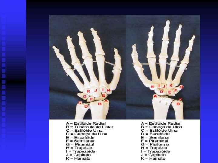 Traumatologia Introduo As fraturas do tero distal do