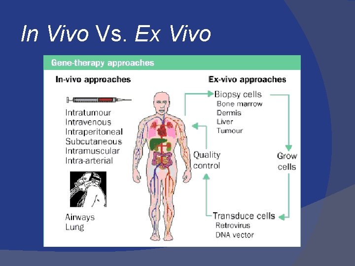 Charlie Mc Laughlin GENE THERAPY FOR GENETIC DISORDERS