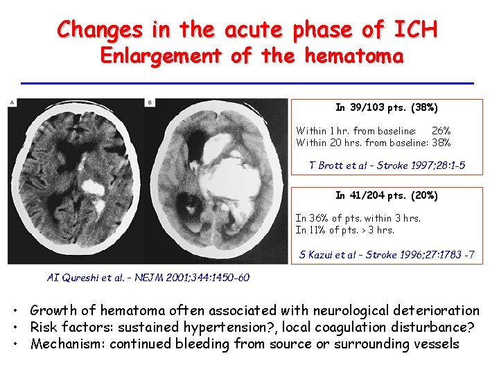 INTRACEREBRAL HEMORRHAGE UPDATE Carlos S Kase MD Neurology