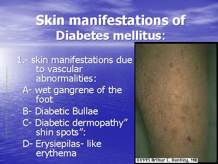 Dermatological Manifestations of Systemic Diseases By Dr Saad