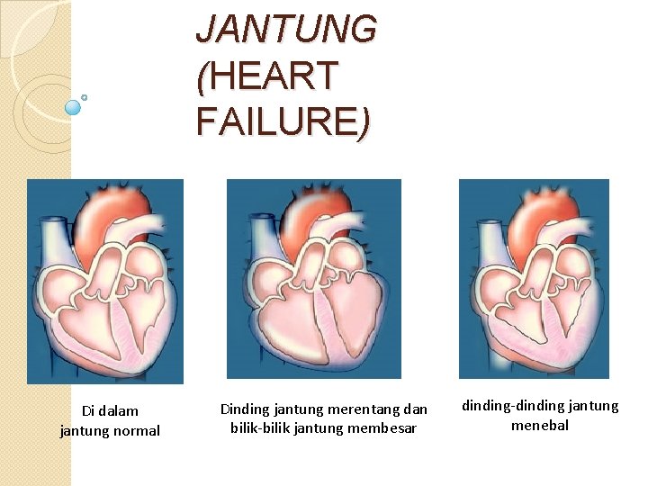 JANTUNG HEART FAILURE Di dalam jantung normal Dinding