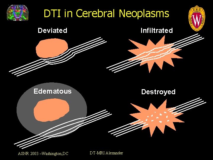 Clinical Use of DTI Guido Gerig MIDAGUNC Acknowledgments
