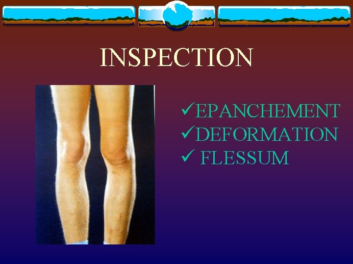 LES ENTORSES DU GENOU PHOTO RAPPEL ANATOMIQUE v