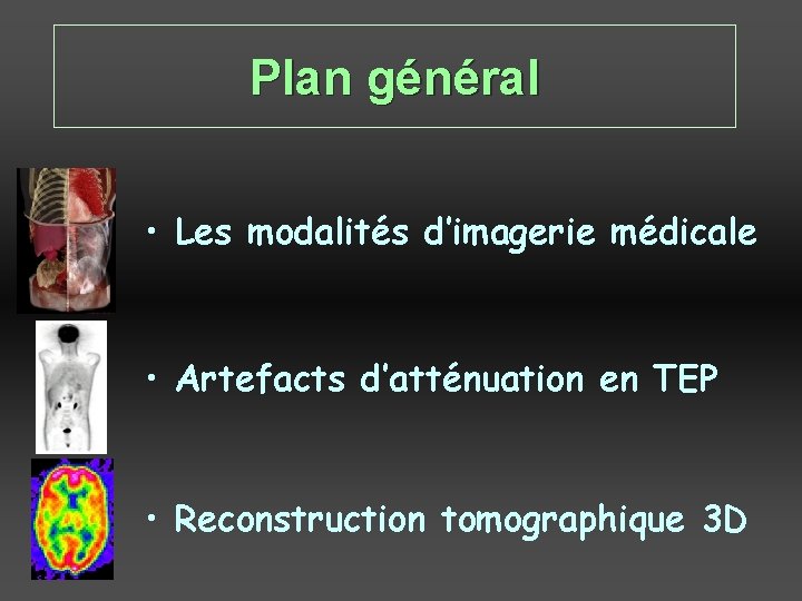 APPORTS DE LA PHYSIQUE A LA TOMOGRAPHIE MEDICALE