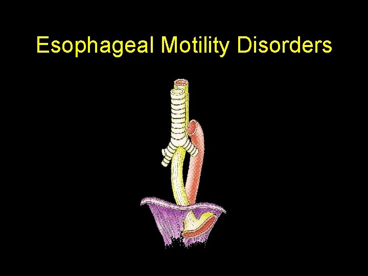 Esophageal Motility Disorders Esophageal Motility Dz Esophageal Disorders