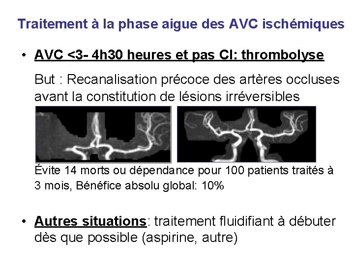 Comment je traite un AVC la phase aigue