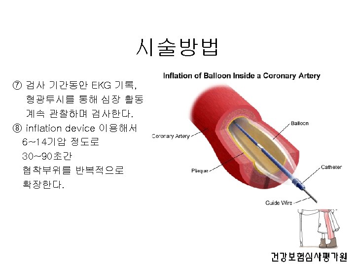PTCA Percutaneous Transluminal Coronary Angioplasty L Main left