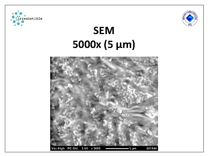 Les 4 Bacterin zichtbaar maken De organismen die