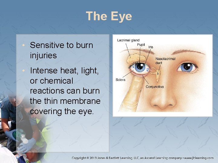 Chapter 32 Burns National EMS Education Standard Competencies