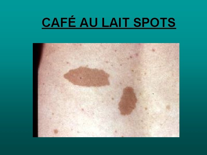 SKIN TUMOURS DR IMRANA ZULFIKAR ASSITANT PROFESSOR SURGERY