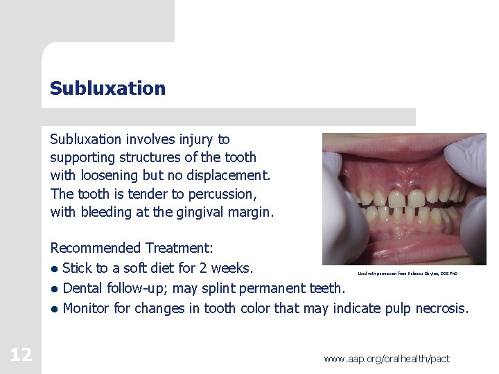 Protecting All Childrens Teeth Oral Injury 1 www