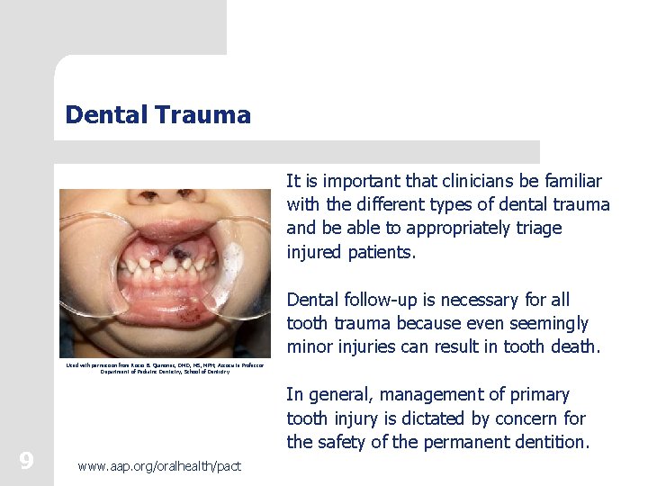 Protecting All Childrens Teeth Oral Injury 1 www