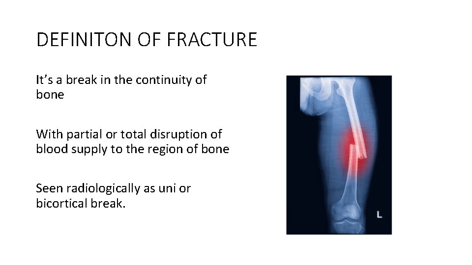 FRACTURE HEALING Dr Mohit Dhingra DEFINITON OF FRACTURE